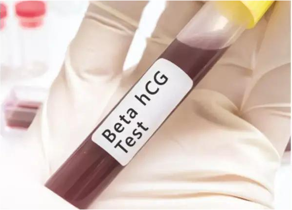 Beta HCG Point Of Care Testing Kits